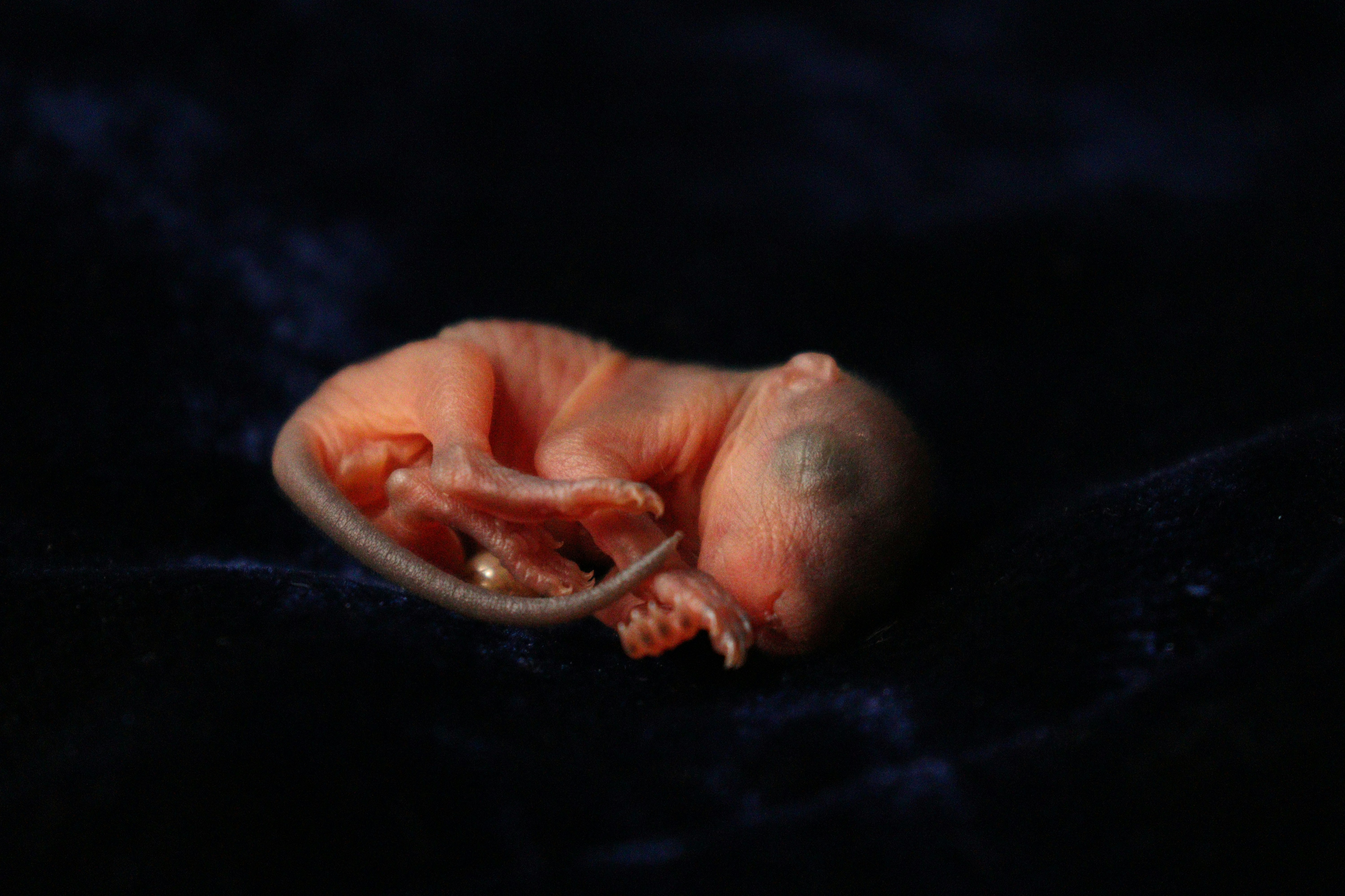 Realistic Photos Of Fetus At 6 Weeks Pictures | Download Free Images on ...