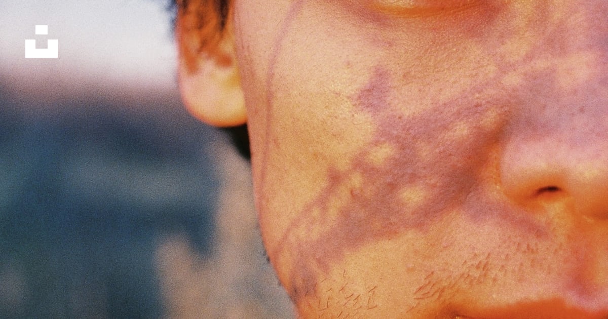 Foto Un Primer Plano De Una Persona Con Pecas En La Cara Imagen
