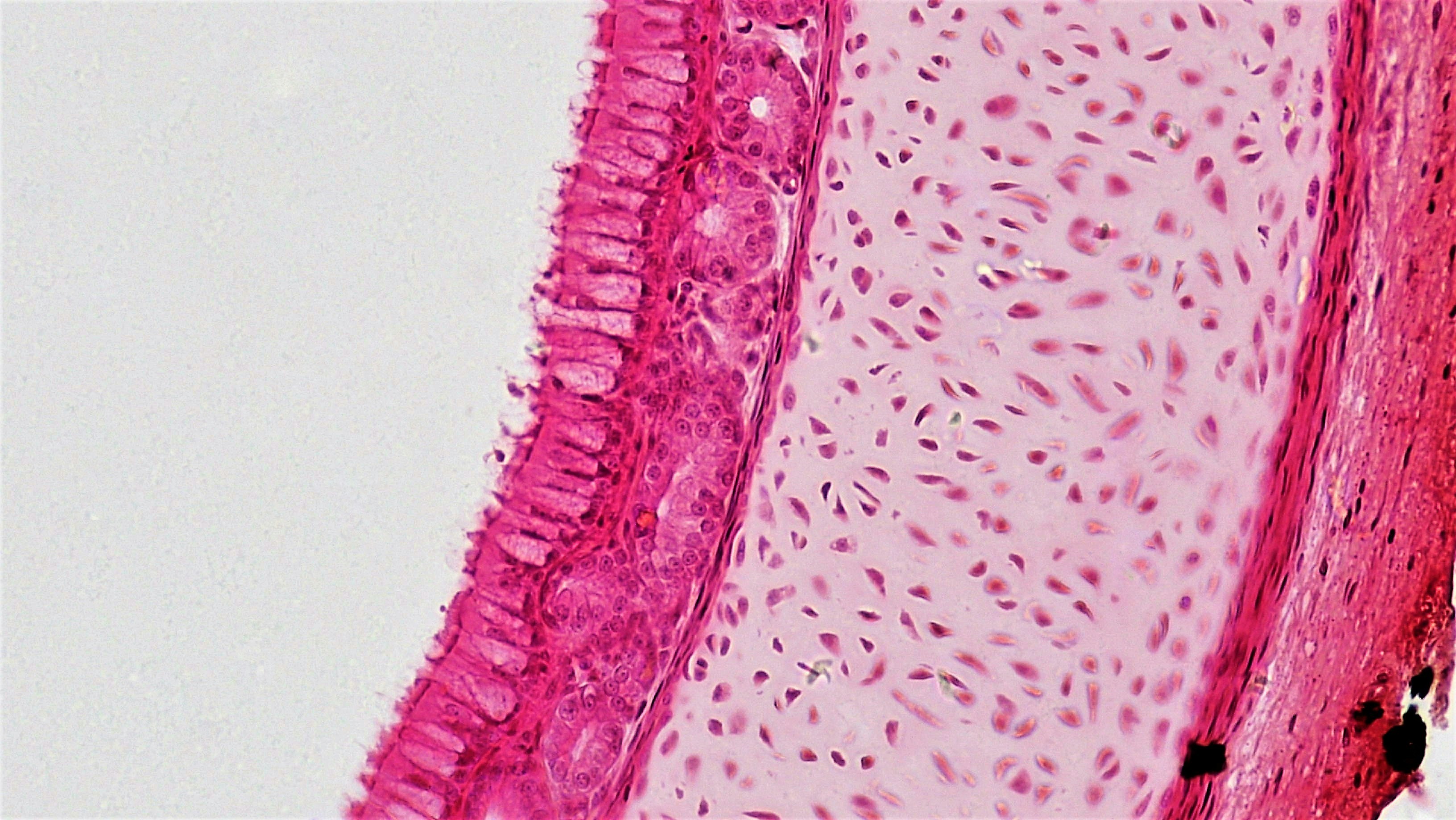 A close up view of a section of a human's stomach photo – Free Https ...