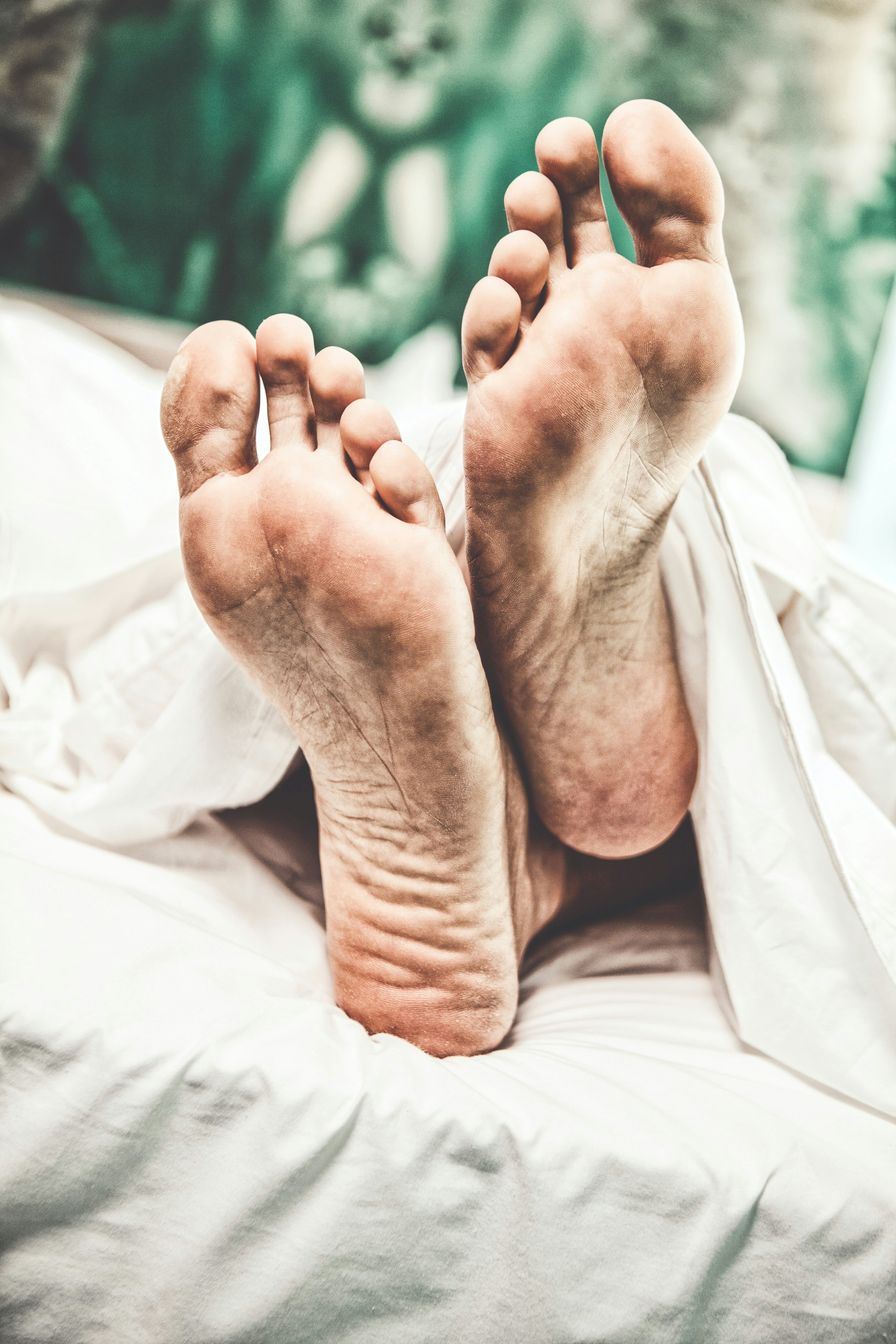 Infeksi Kaki Diabetik: Jenis & Penanganannya - Diabetes