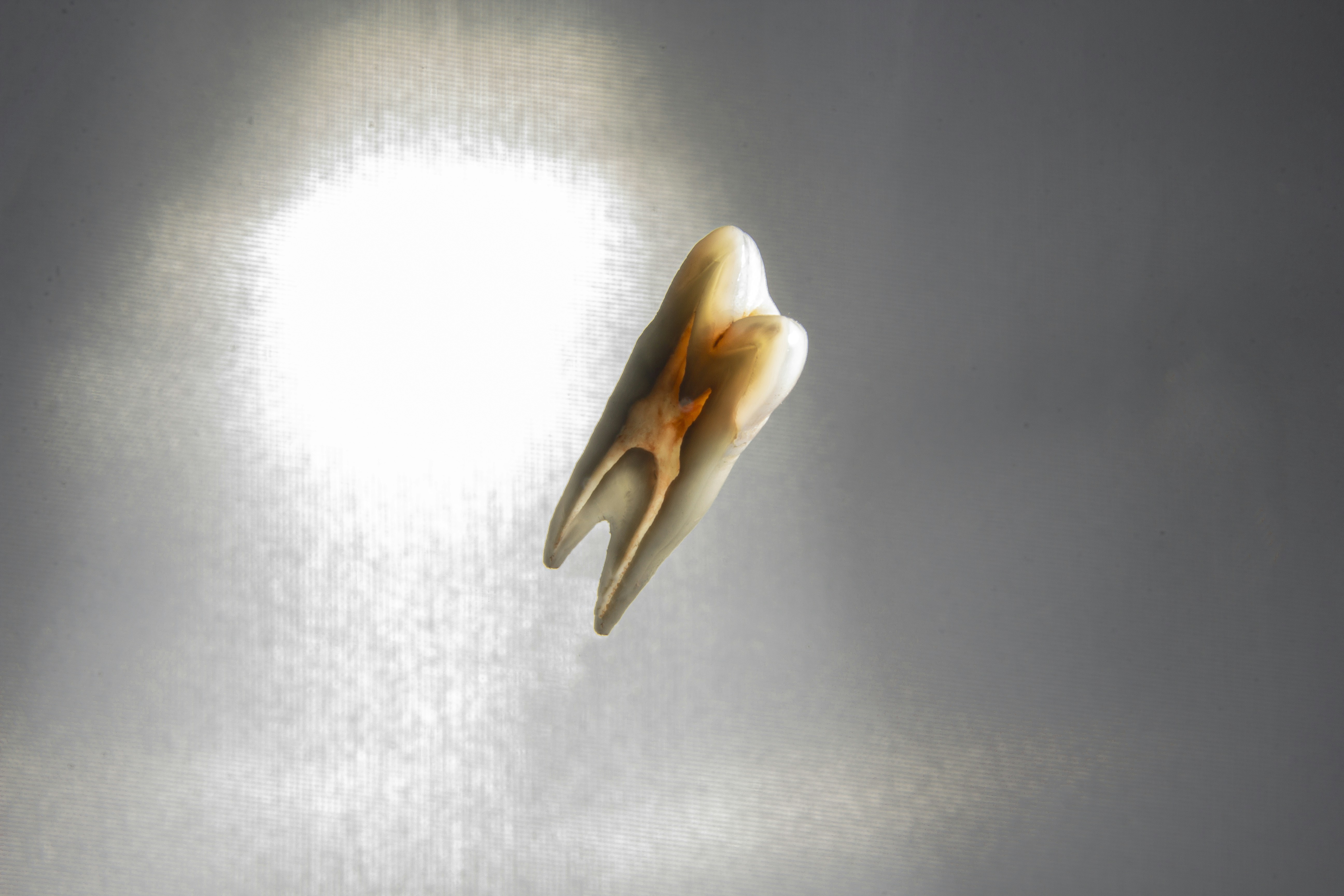 Stress & Your Smile: The Unseen Toll on Dental Health | Teethment