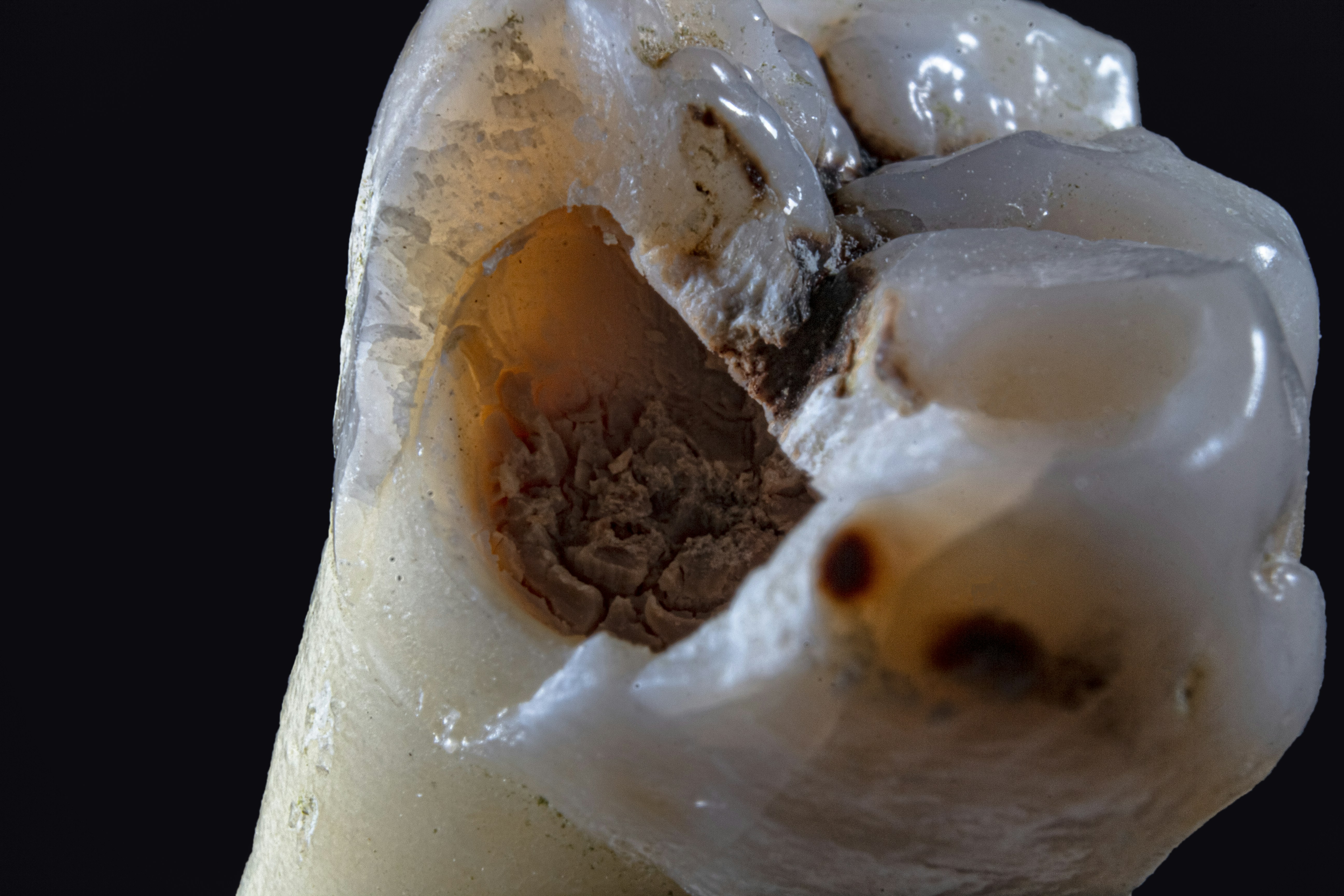 Picture Of Human Ear Grazed By Bullet Pictures | Download Free Images ...