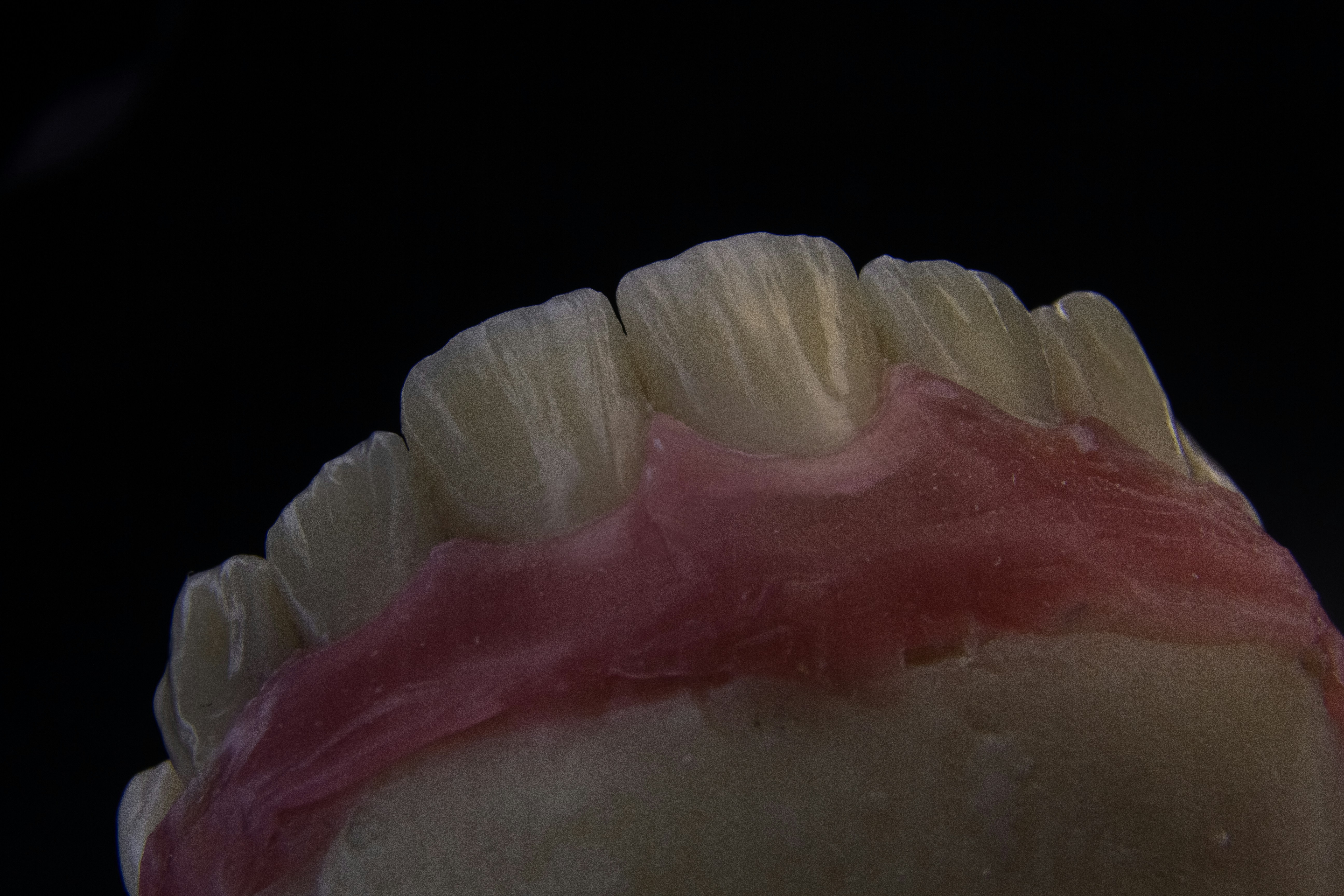 A close up of a tooth with a pink substance on it photo – Free Teeth ...