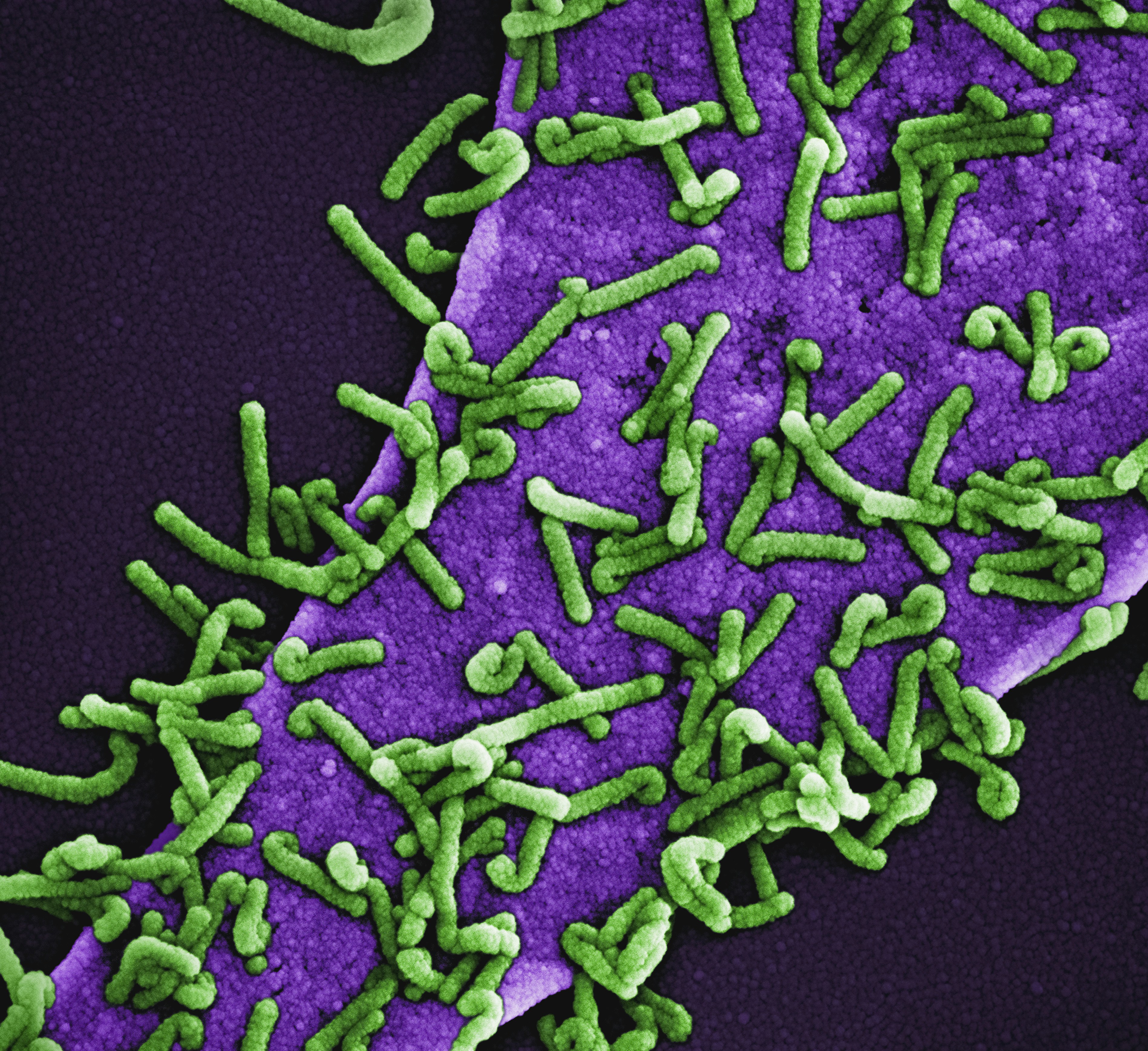 A close up of a purple and green substance photo – Free Microbe Image ...