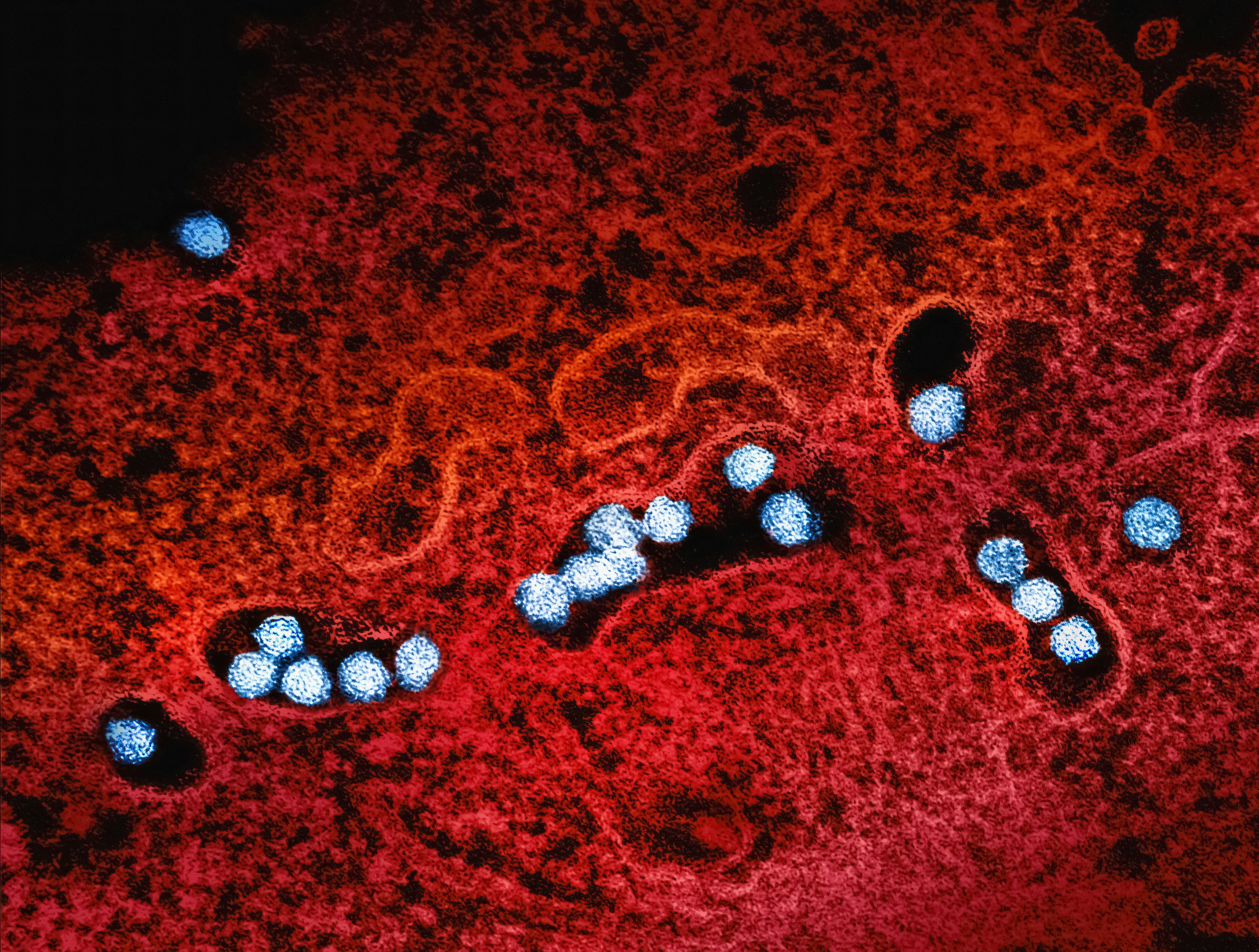 An animal cell with blue dots on it photo – Free Pathogen Image on Unsplash