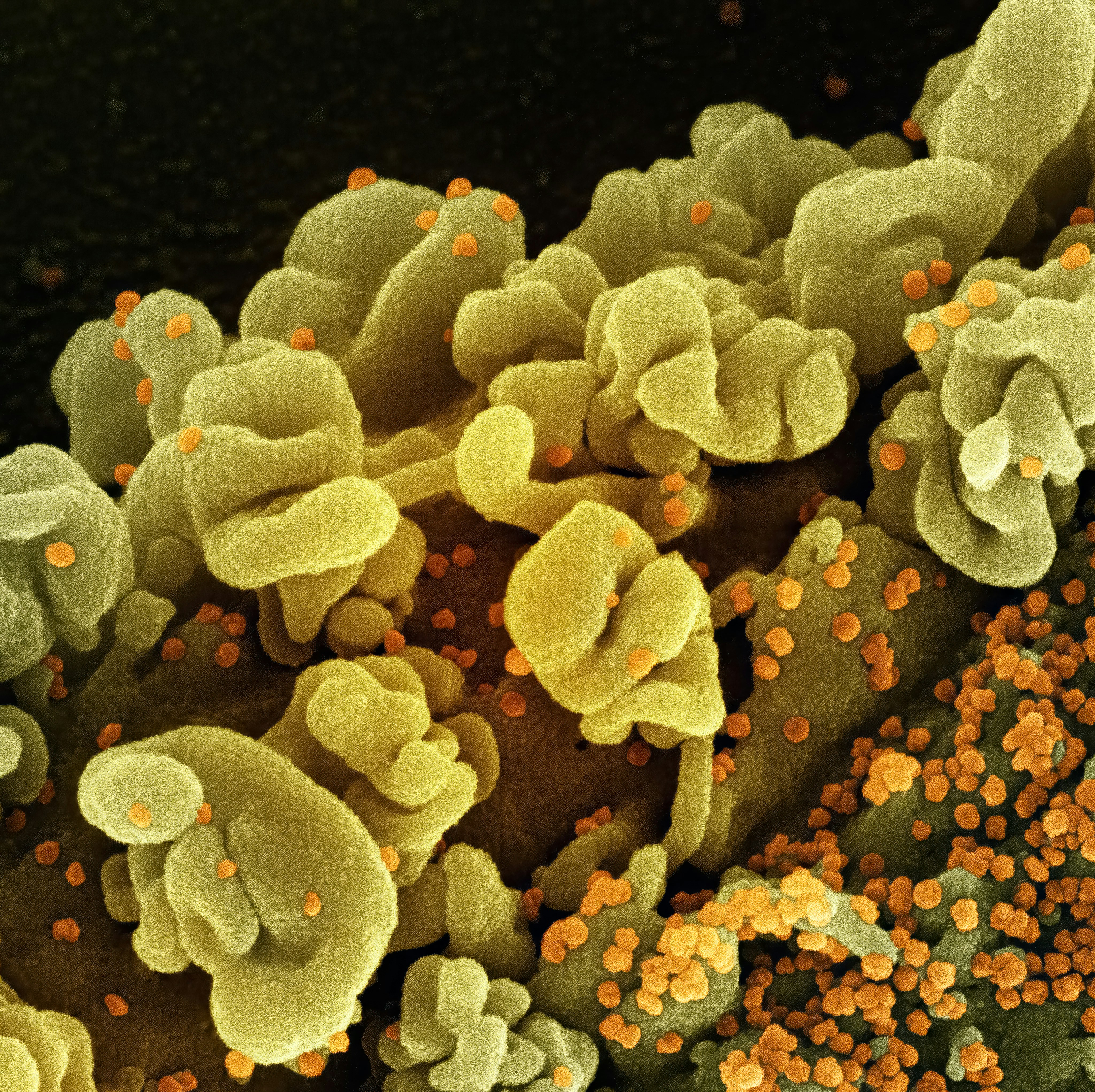 A close up of a group of yellow and orange algae photo – Free Pathogen ...