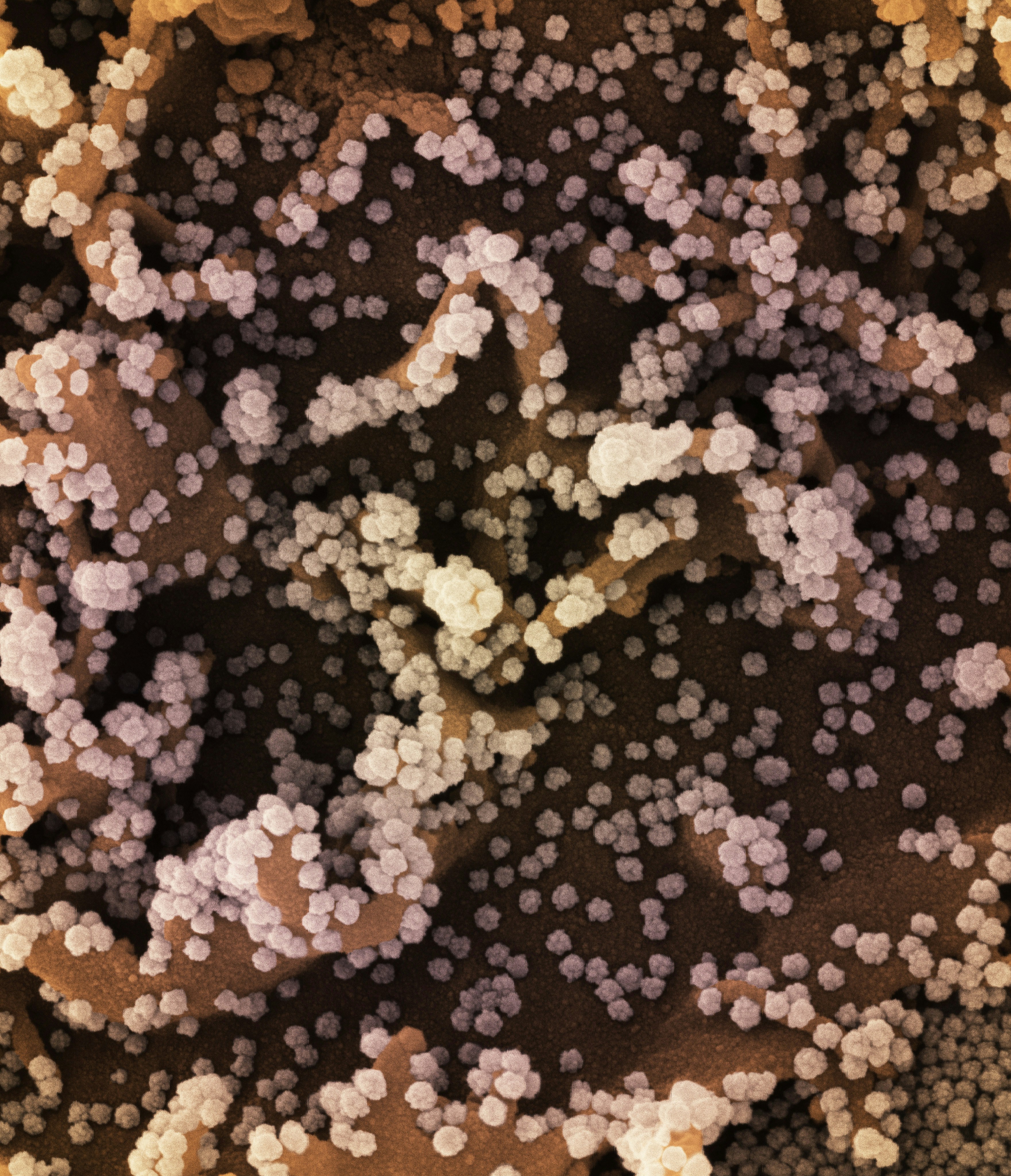 A close up of a cell phone with dots on it photo – Free Pathogen Image ...