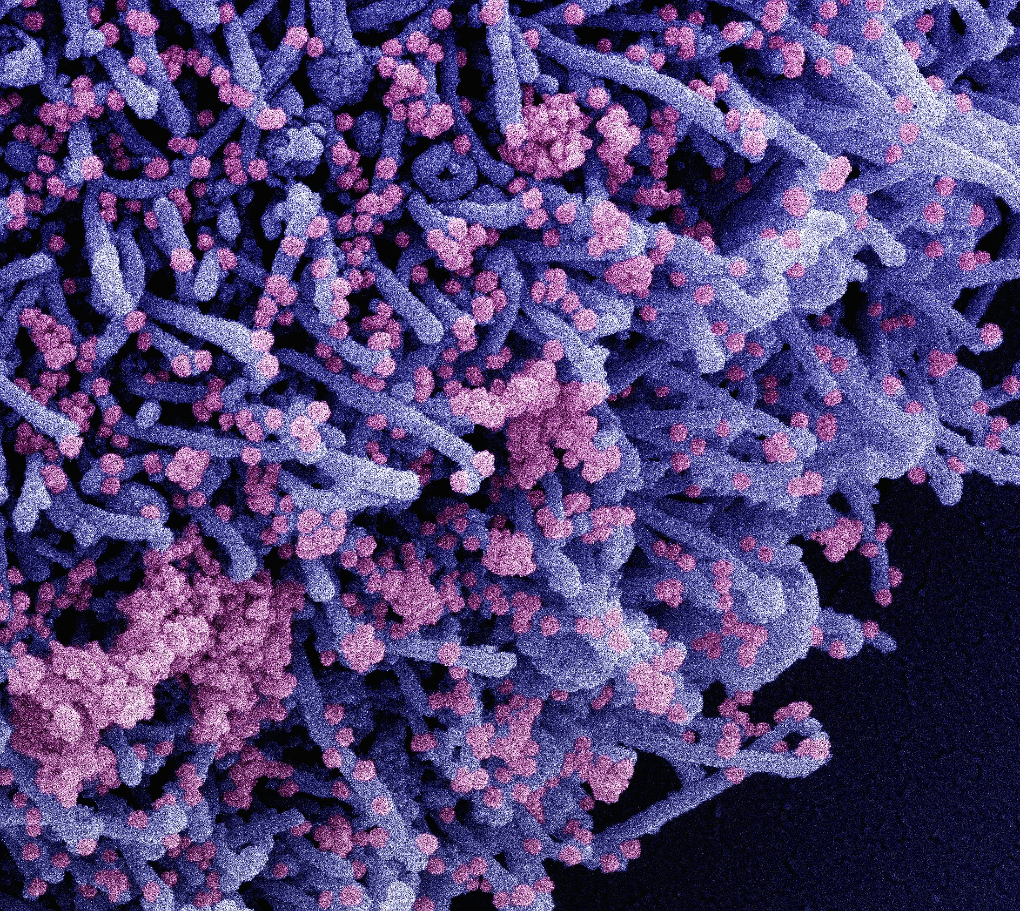 A close up of a purple and pink substance photo – Free Pathogen Image ...