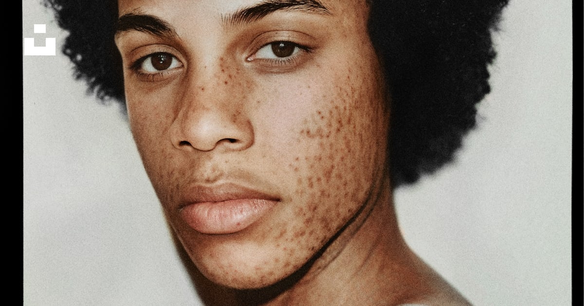 Ai Generated Portrait Of A Black Freckled Male Model With Bare