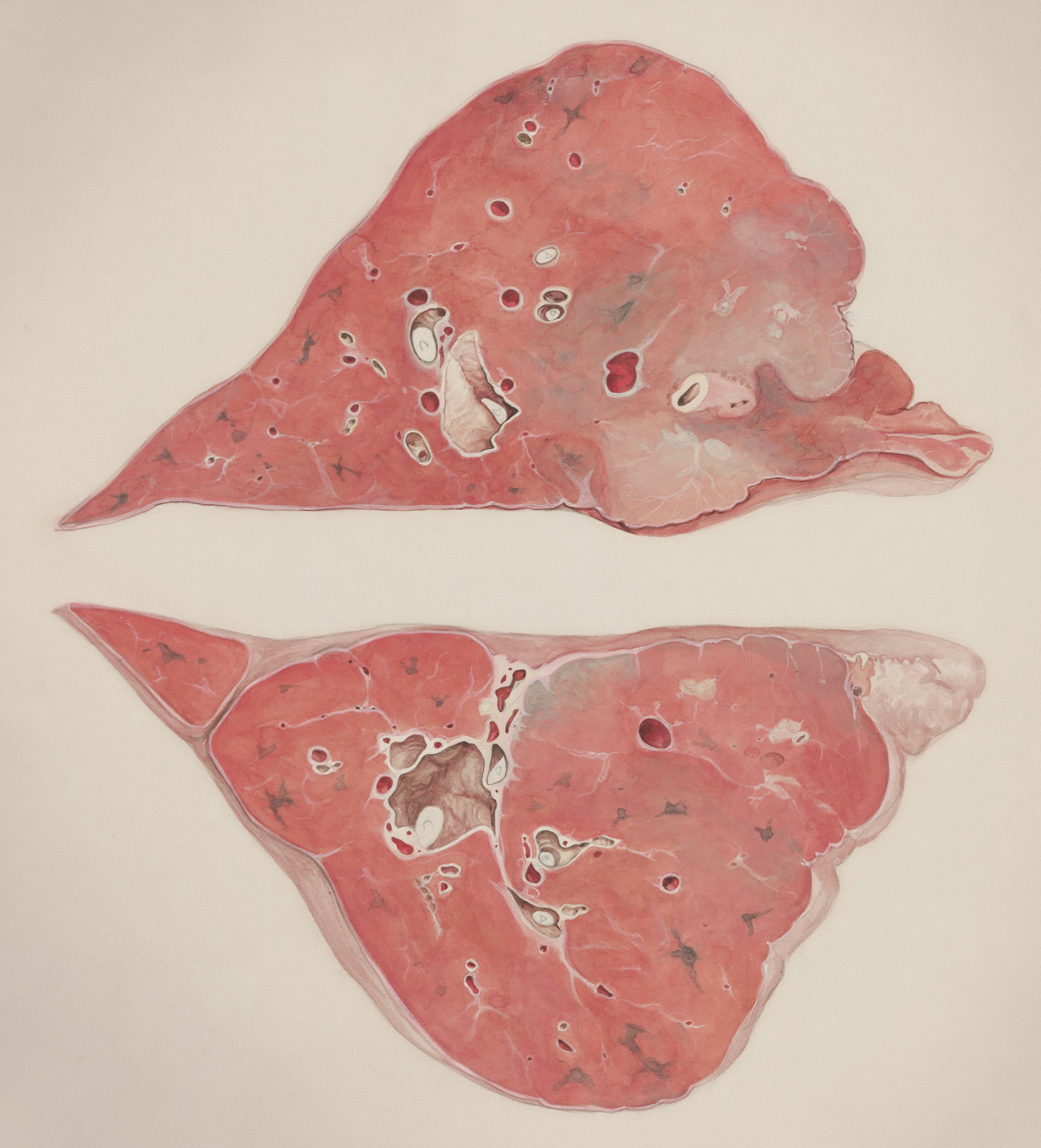 A picture of two sections of a liver photo – Free Grey Image on Unsplash