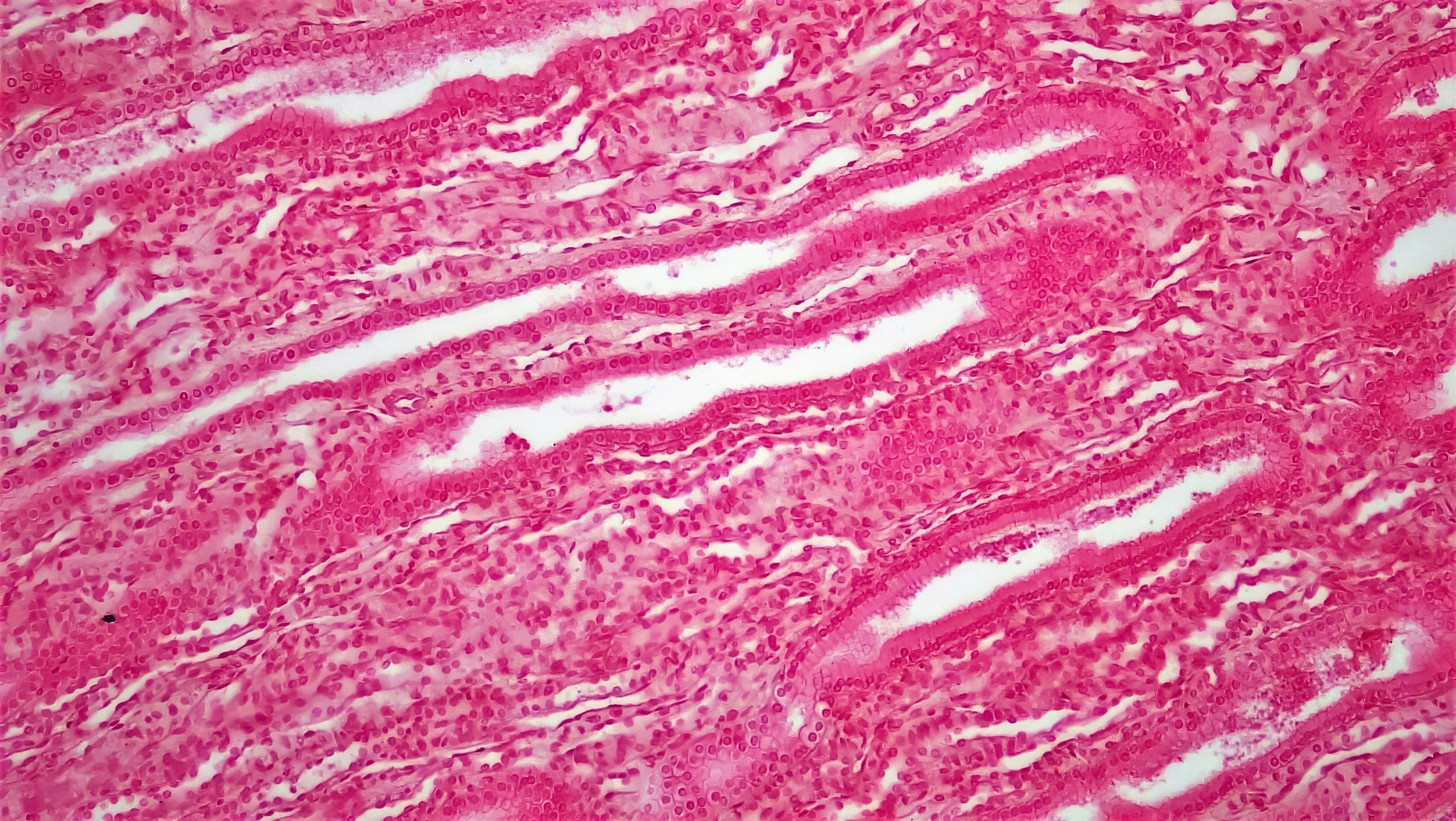 Tejidos epiteliales: epitelio cuboidal simple foto – Imagen de Rosado ...