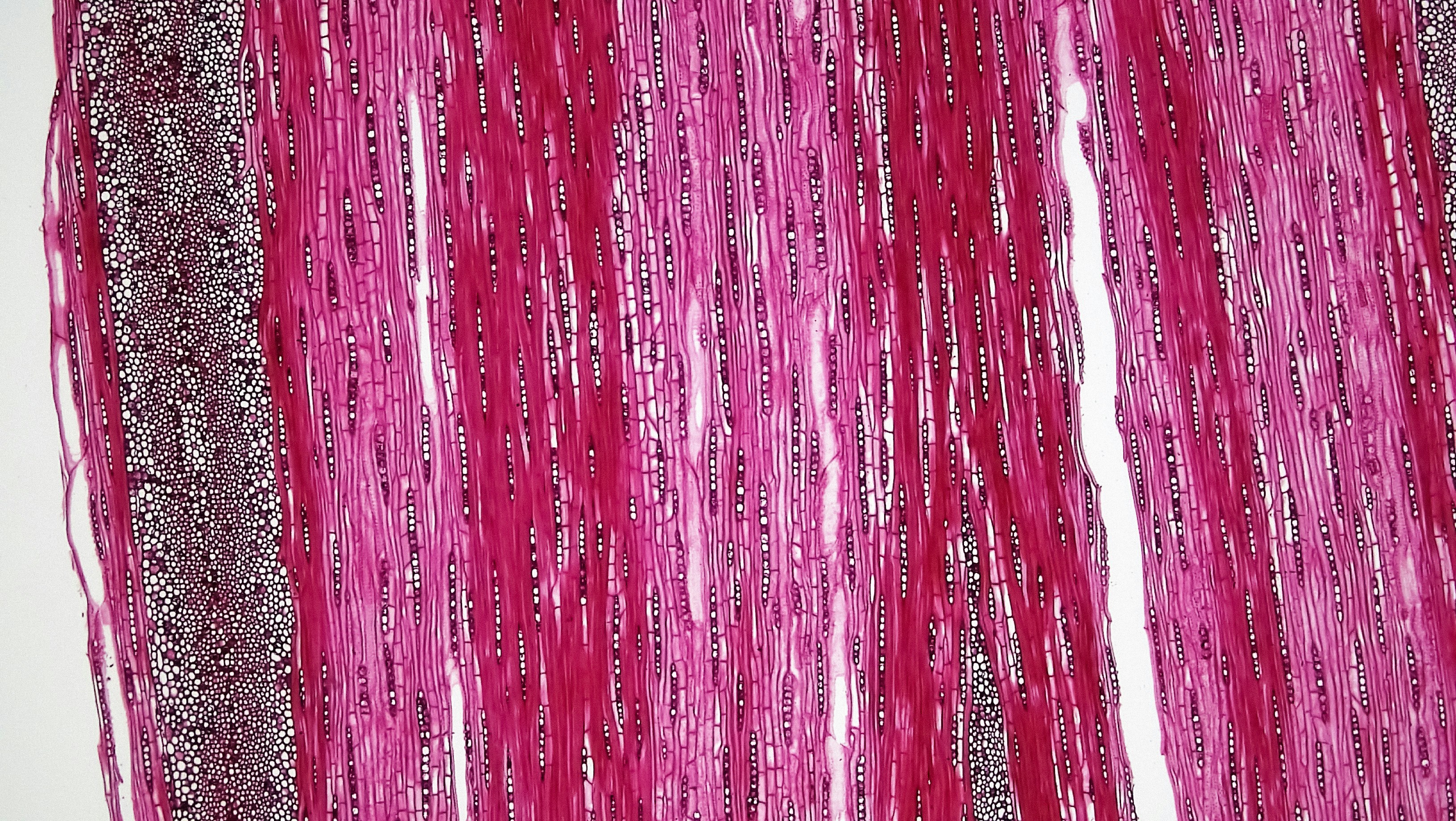 Woody dicot stem: Tangential Section Quercus 40x photo – Free Organic ...