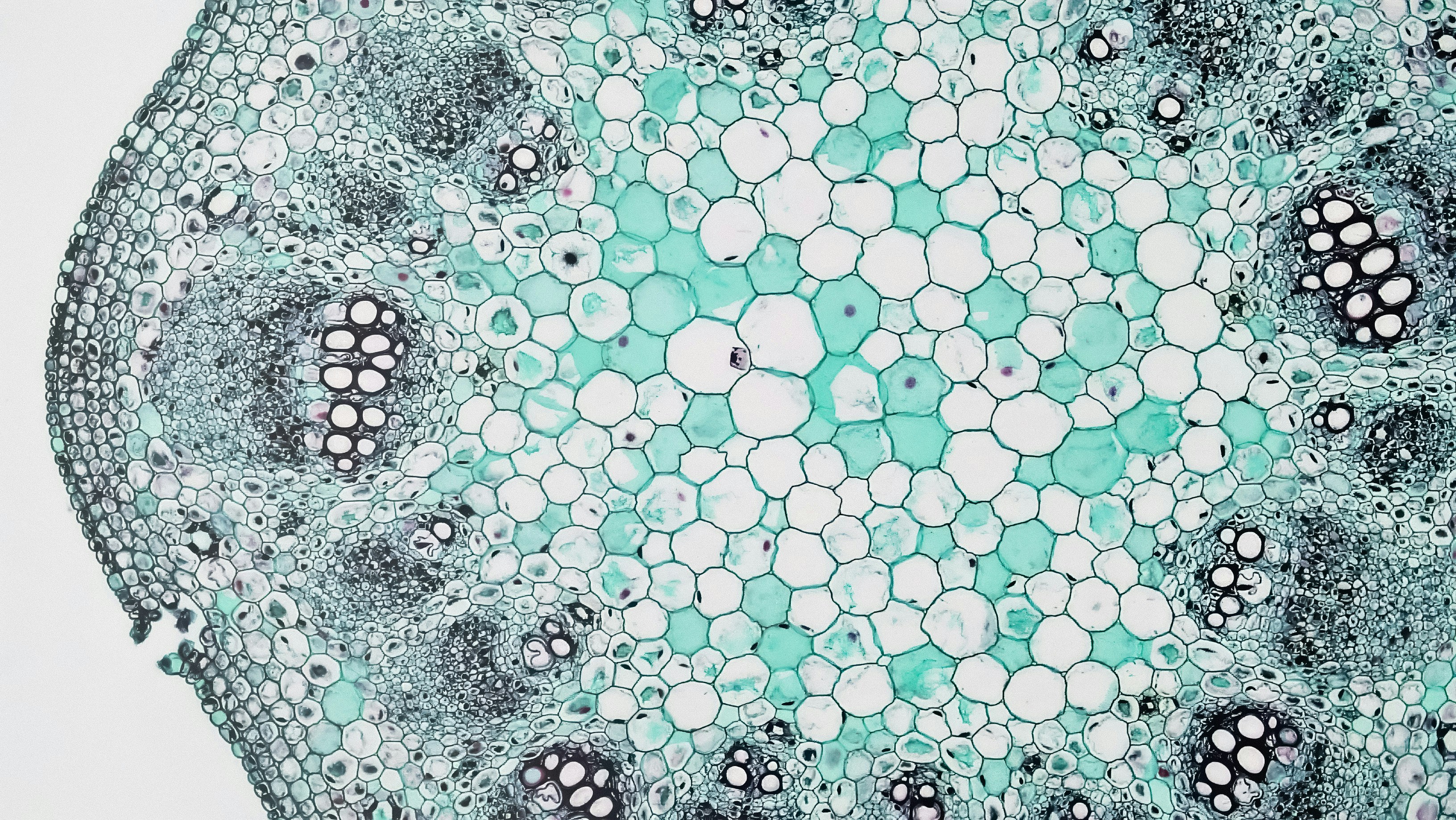 Herbaceous Dicot Stem: Stomata in Older Helianthus photo – Free Pattern ...