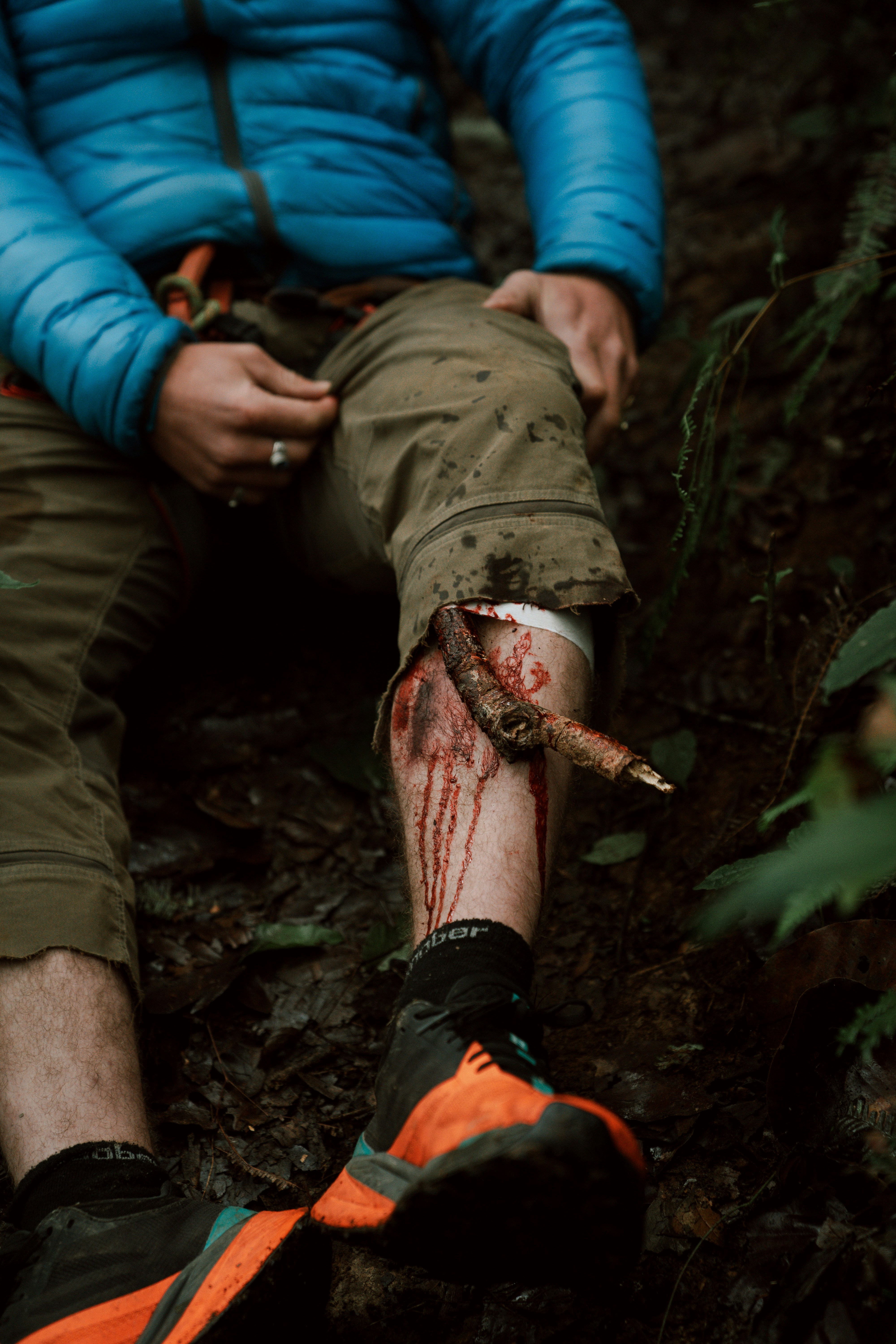 Bloodied path: a lone hiker tending a wounded leg in the forest