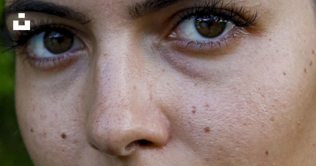 Un Primer Plano De Una Mujer Con Pecas En La Cara Foto Imagen De