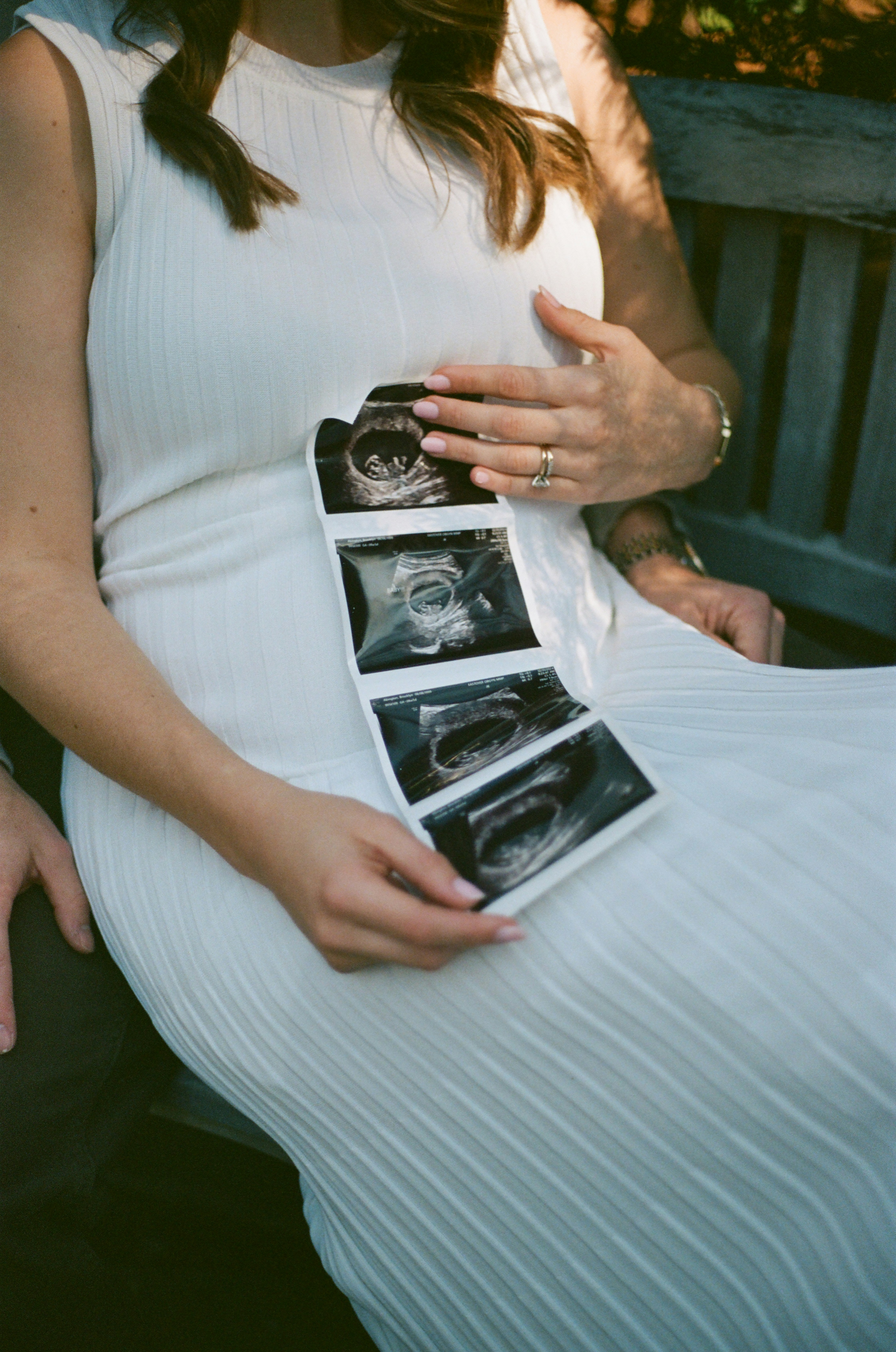 Photograph of a pregnant woman in a white ribbed dress outdoors, holding ultrasound photos across her lap.