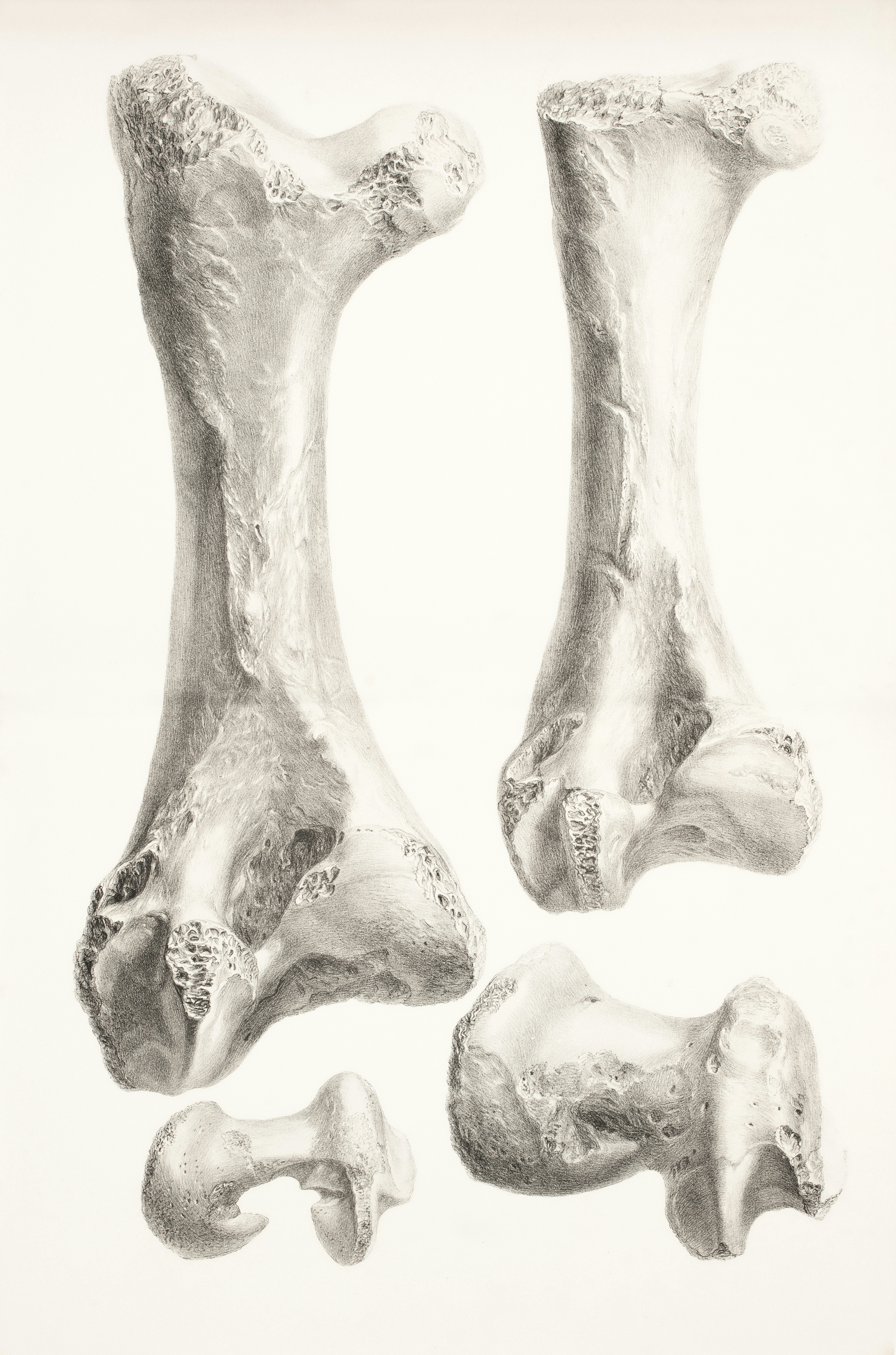 Una ilustración de los huesos del muslo humano. foto – Imagen de Huesos ...