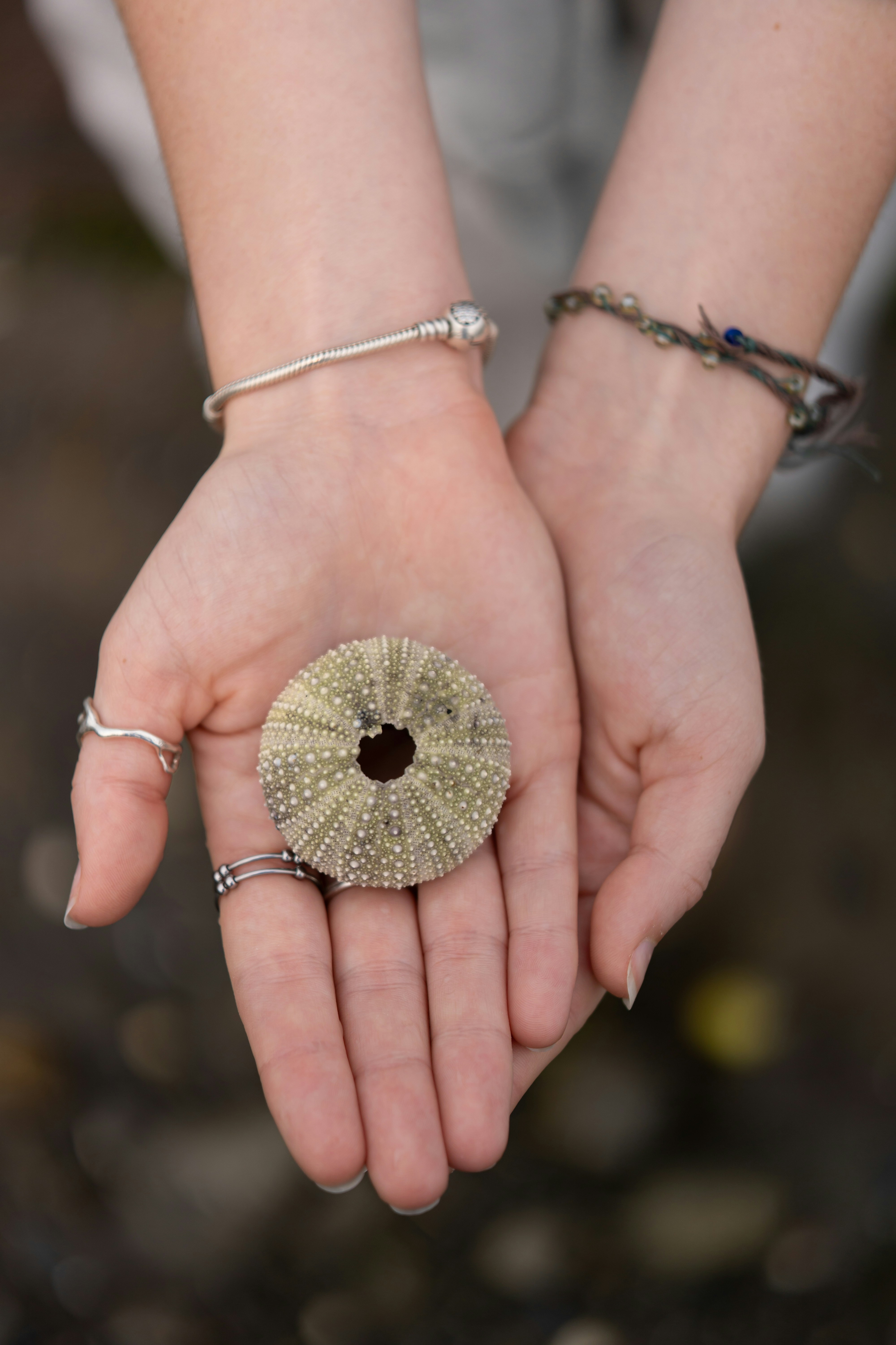 Nature's Subtle Treasure: The Sea Urchin Encounter
