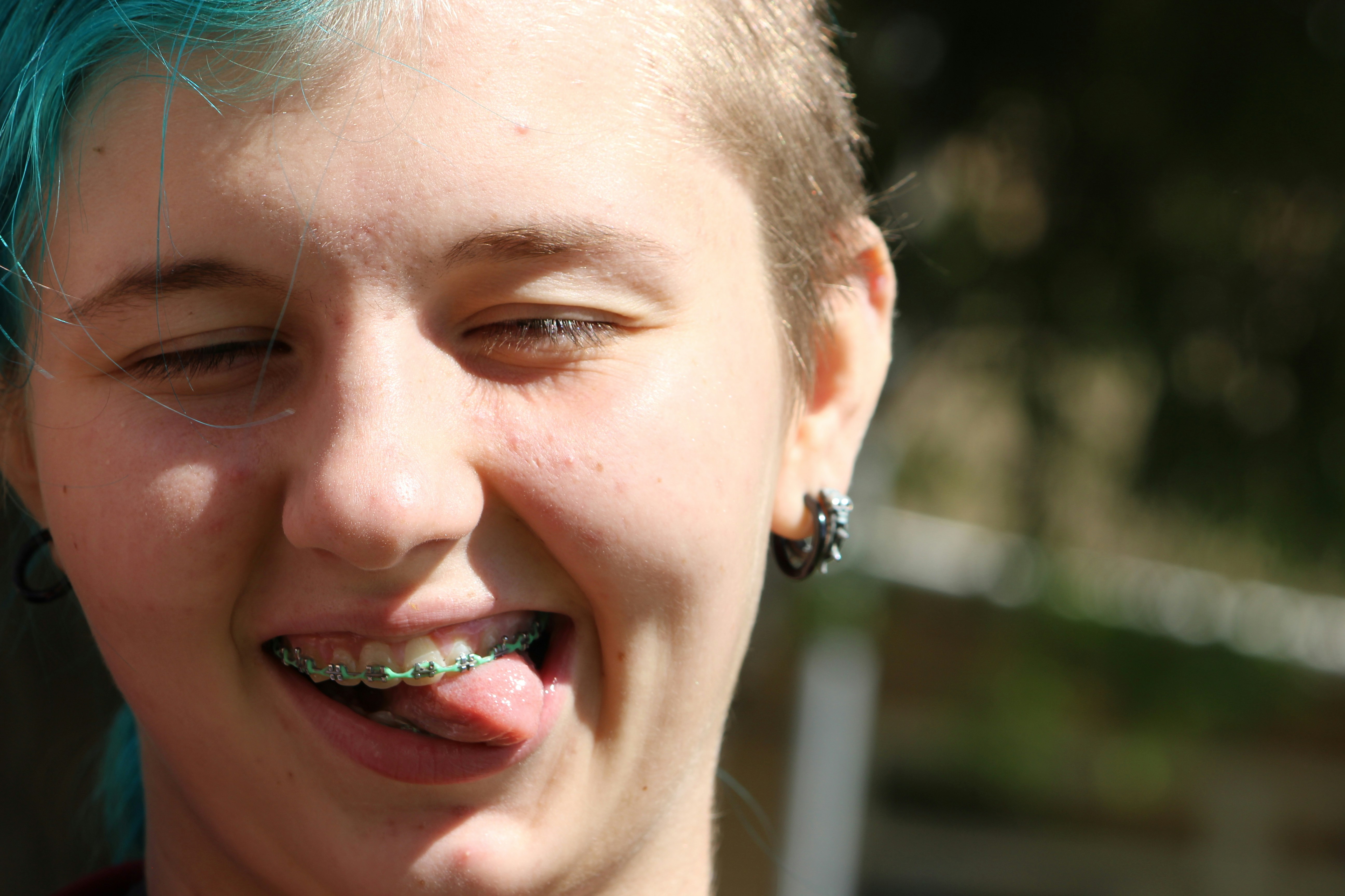 Close-Up of a Playful Smile and Tongue with Braces