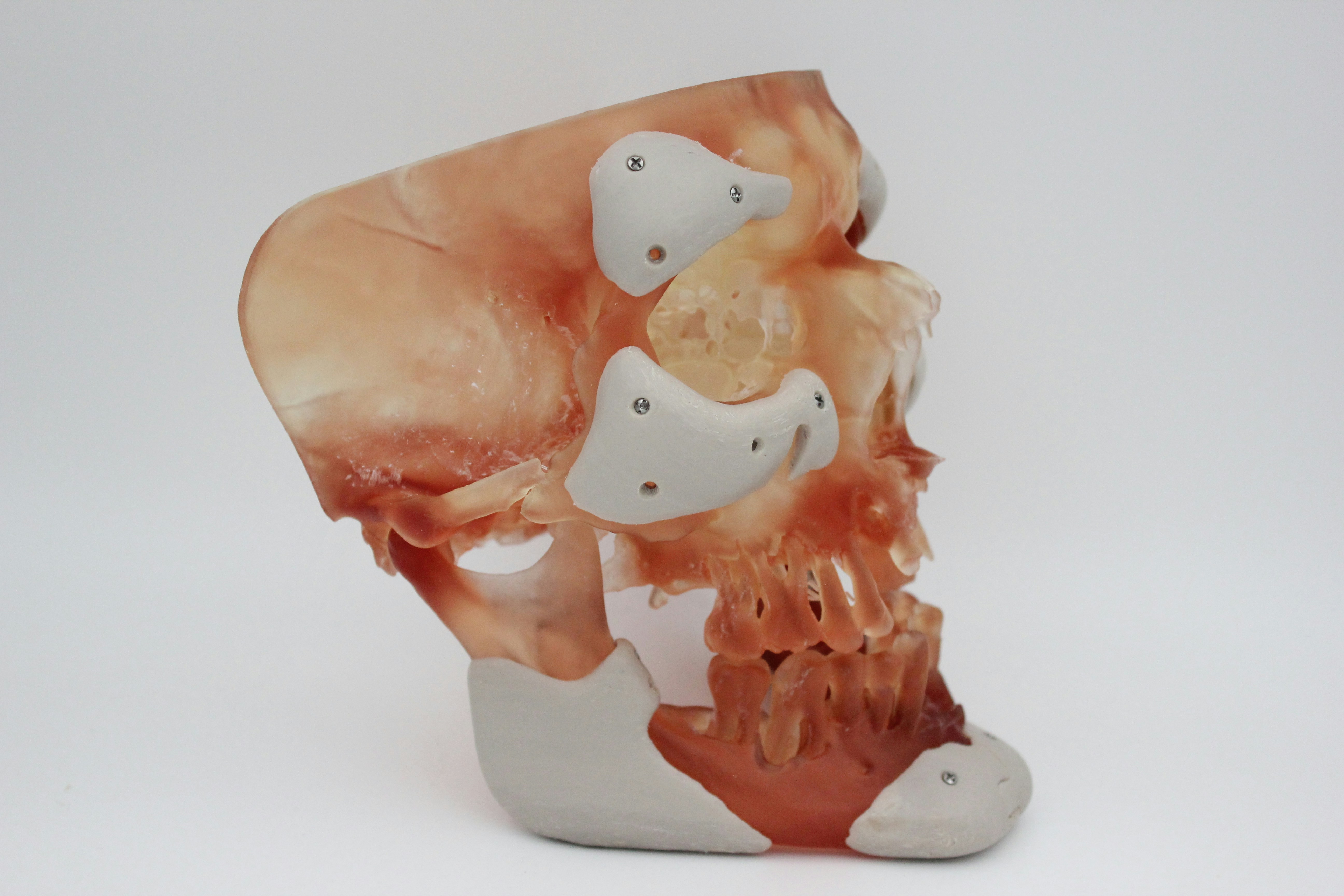 Fragmented Skeleton: A Ceramic Skull in Soft Light