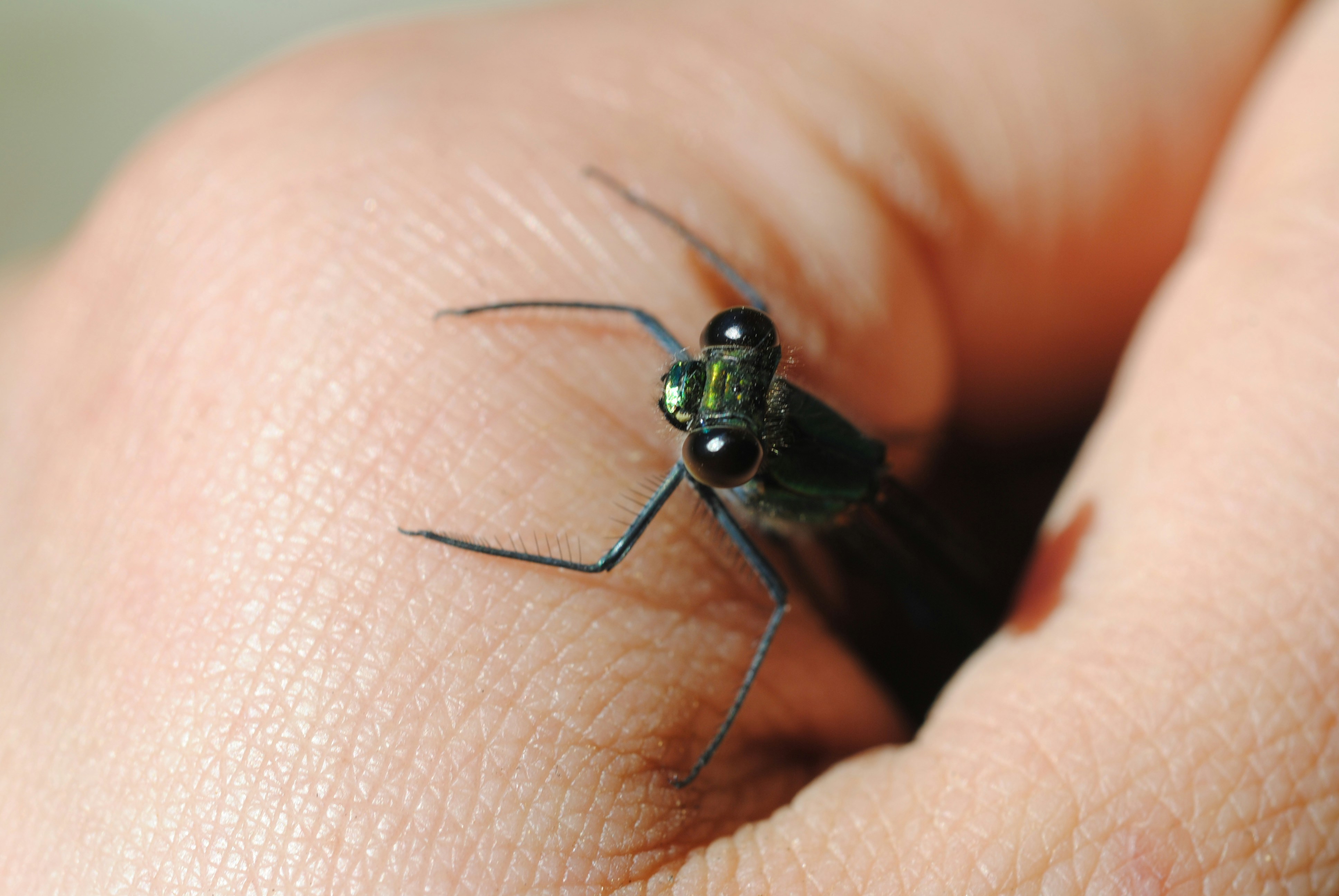 Emerald-eyed Beetle on Human Skin: A Close Shutter Encounter