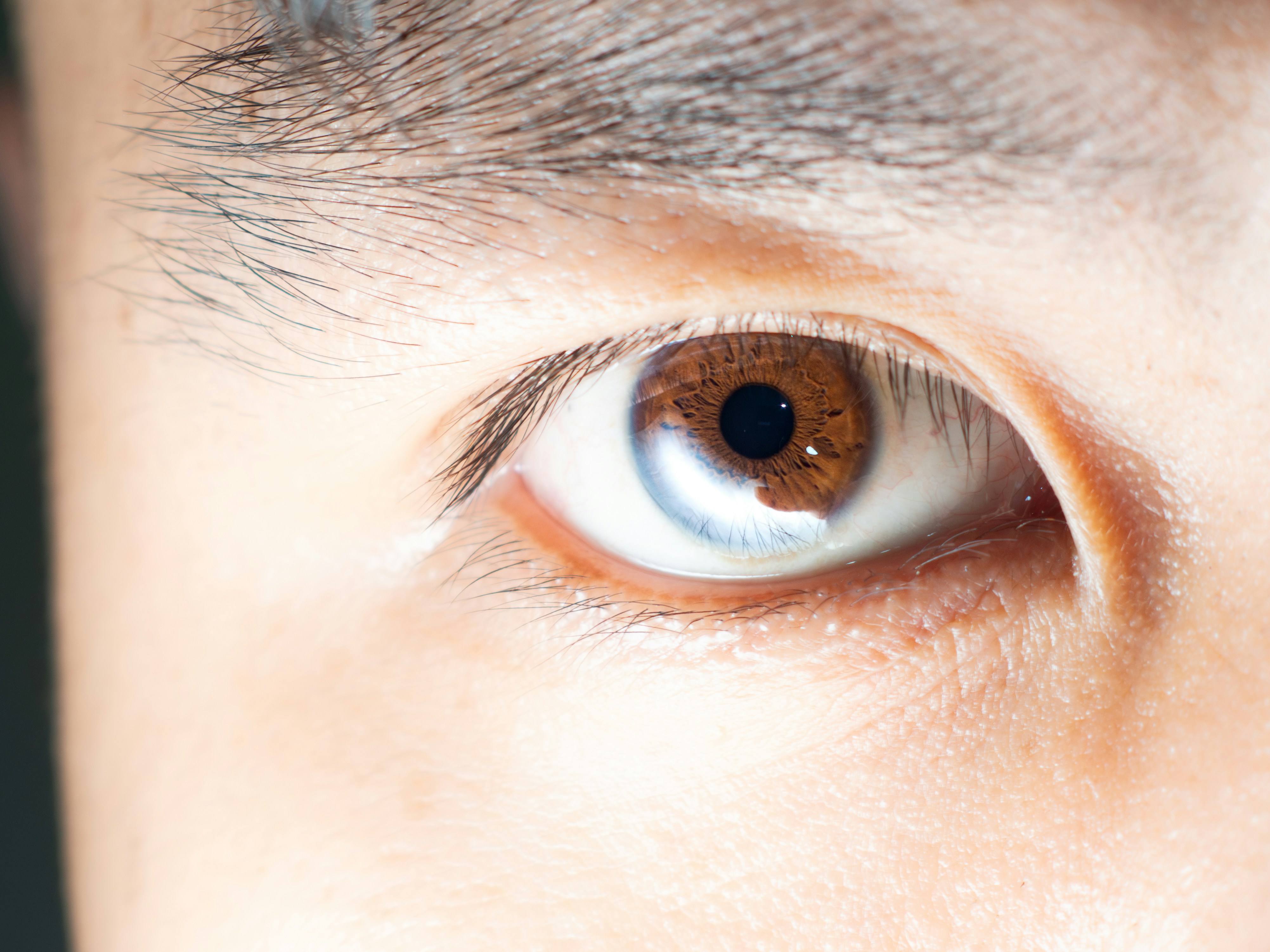 Close-up of a brown iris and surrounding skin with visible eyelashes and brow, highlighting the eye as the central element.