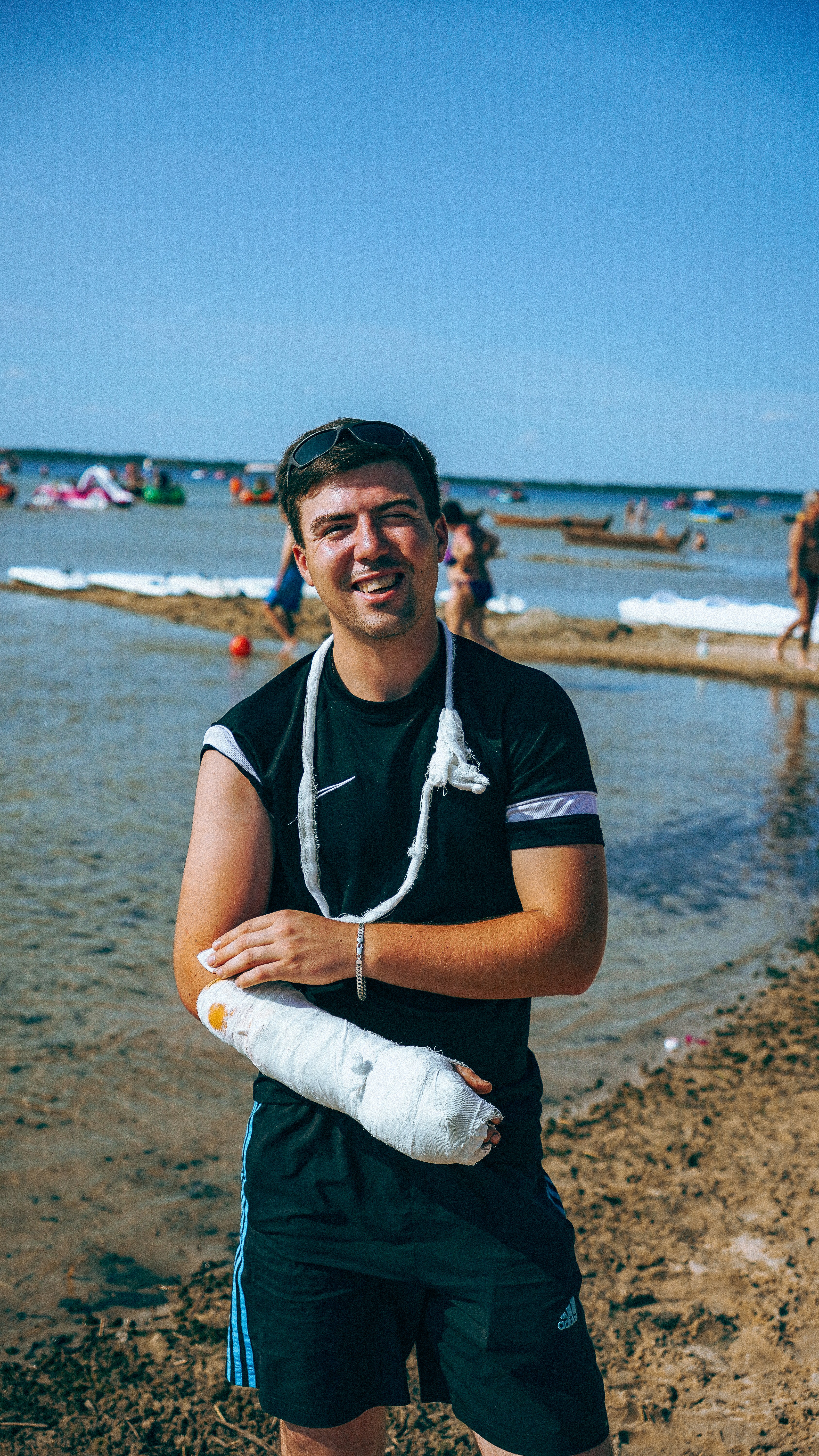 Beachside Resilience: A Grinning Surfer with a Sling on the Shore