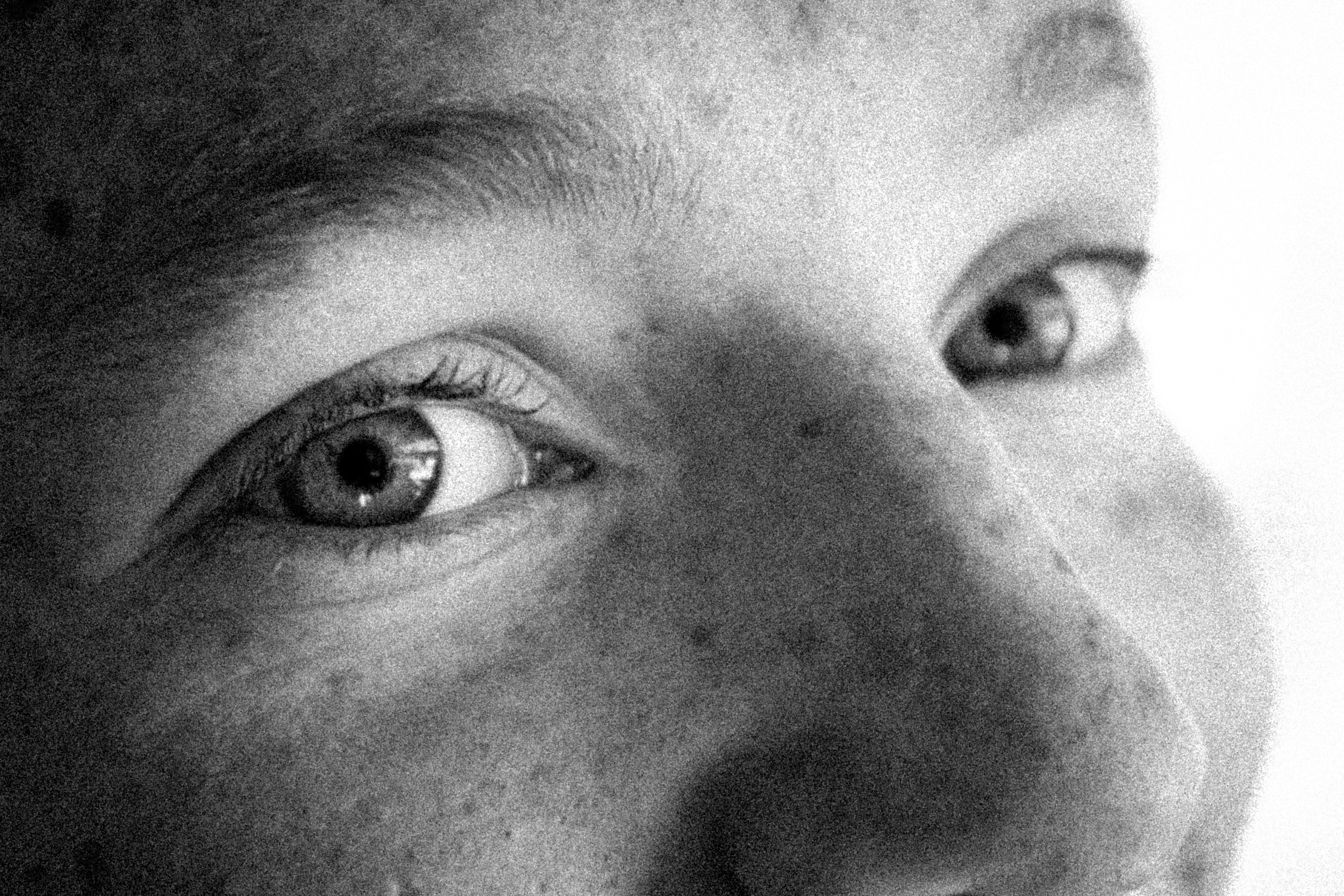 High-contrast close-up of a young face with an emphasis on the left eye, rendered in grayscale to highlight skin texture and micro-details; likely a portrait study or facial detail.