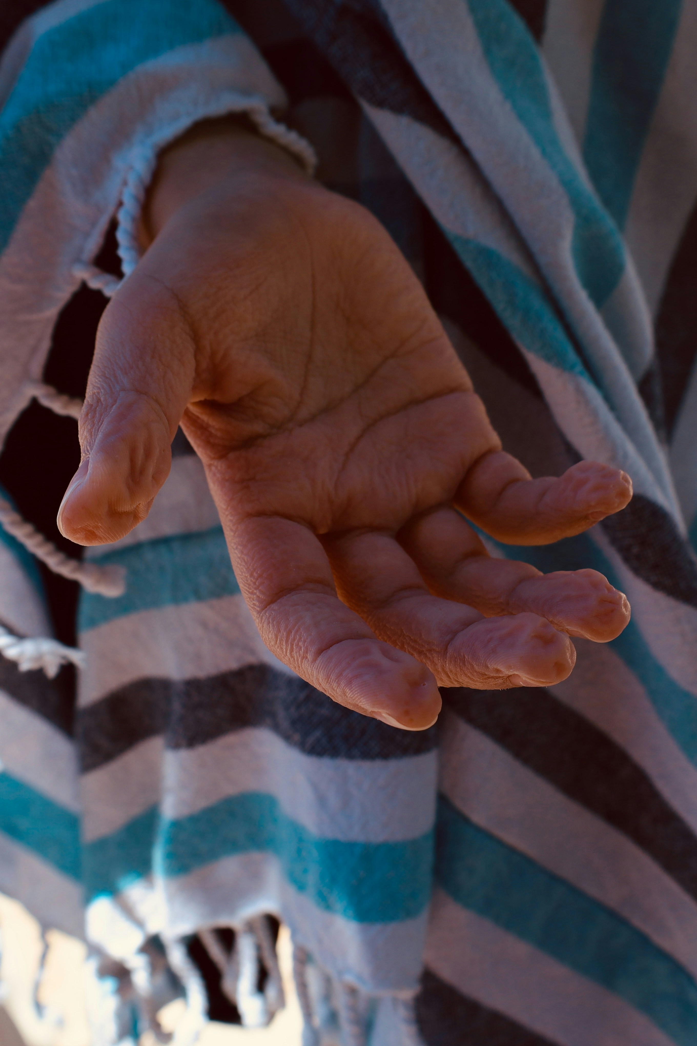 Open Palm in Striped Cloak: a Quiet Gesture of Waiting