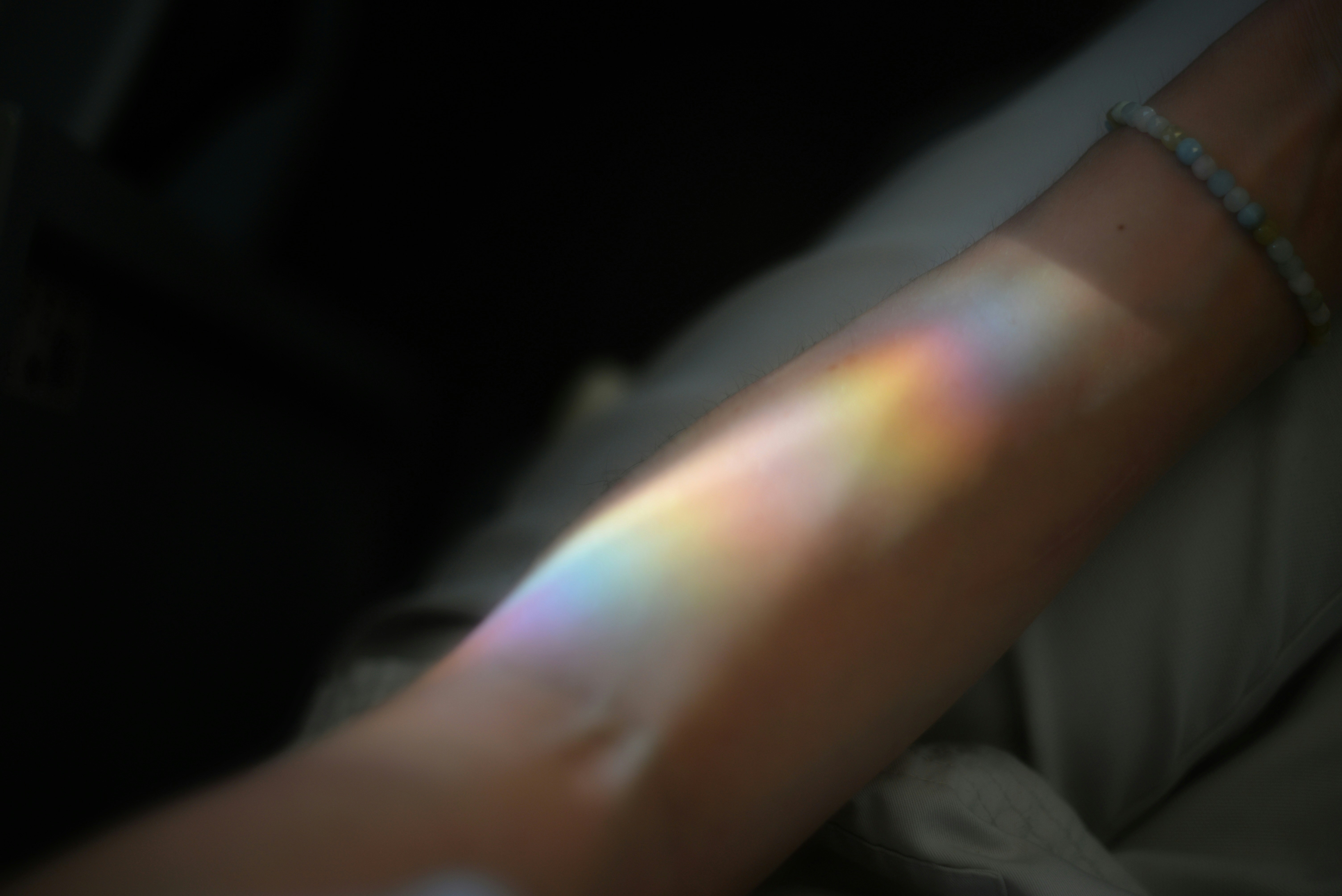 Prismatic Light on a Forearm